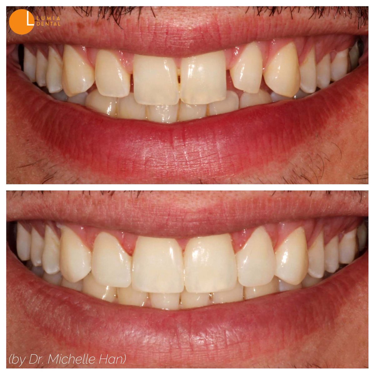 Cosmetic Dentistry NYC by Lumia Dental in Lower Manhattan